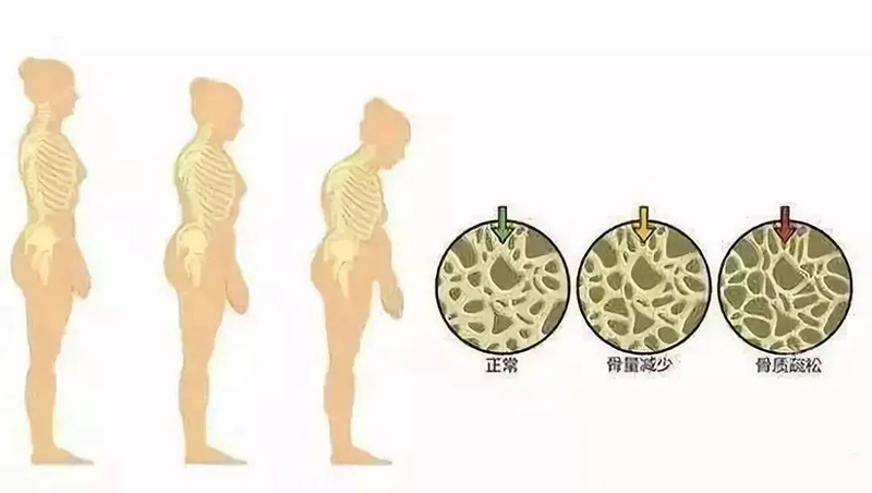 CalGo®：突破性骨骼健康方案-大昌华嘉Discover